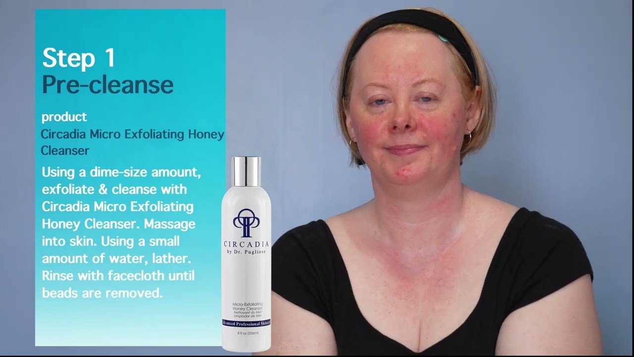 Brightening Treatment Video - Full Moon Esthetics